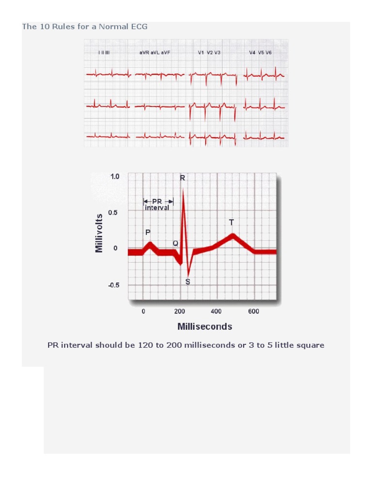ECG Rules for Medical Professionals | PDF | Science & Mathematics