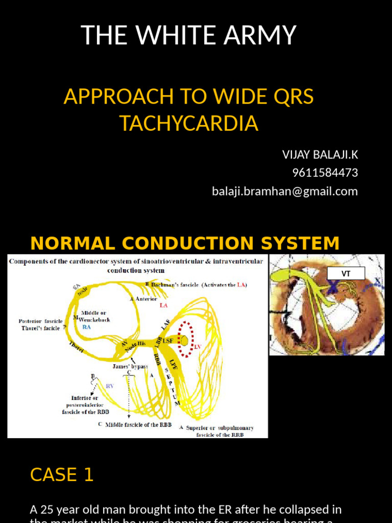 Approach to Wide Qrs Tachycardia | PDF | Electrocardiography | Medical ...