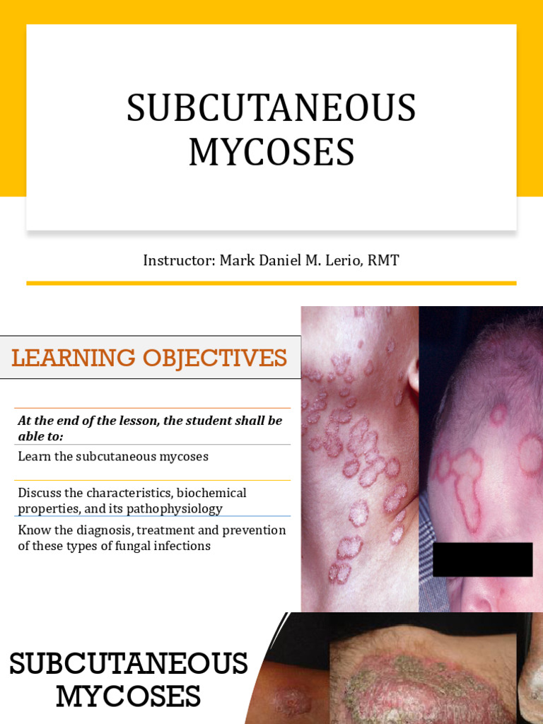 3 Subcutaneous Mycoses | PDF | Infection | Fungus