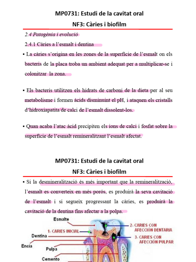 MP0731: Estudi de La Cavitat Oral NF3: Càries I Biofilm: 2.4 Patogènia ...
