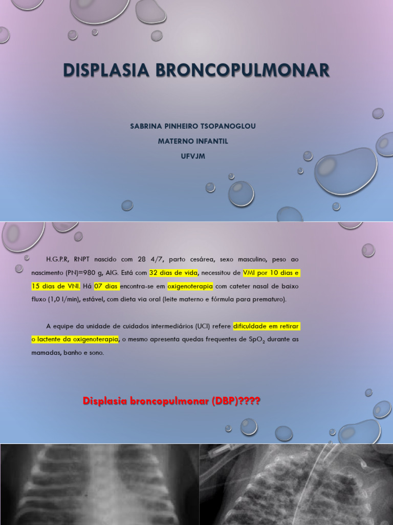Displasia broncopulmonar - DBP | PDF | Doença de obstrução pulmonar ...