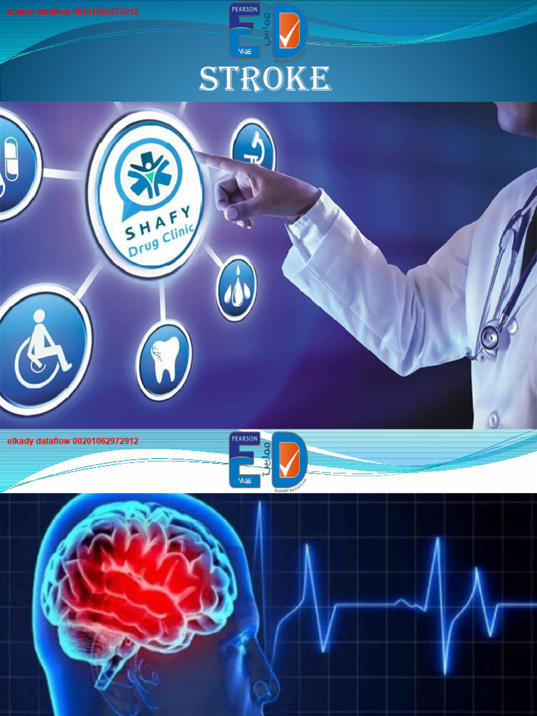 lec (4) stroke شرح برومترك صيدله السكته الدماغيه اوالجلطه الدماغيه | PDF
