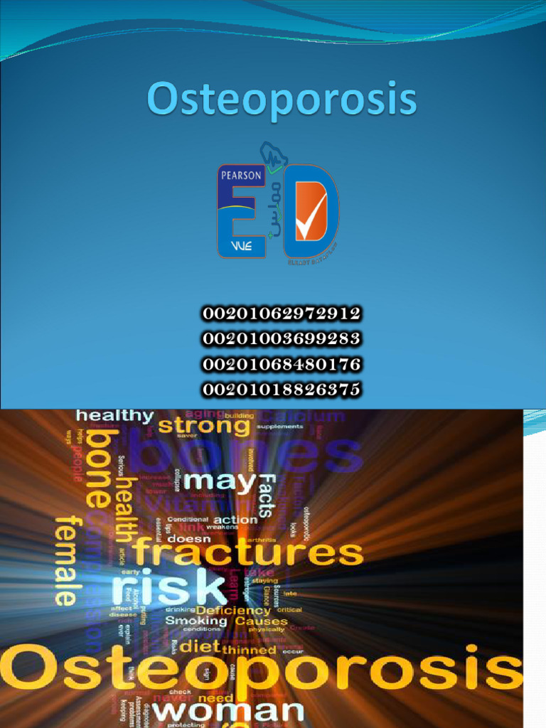 LEC17 Osteoporosis شرح برومترك صيدله هشاشة العظام | PDF | Osteoporosis | Bone