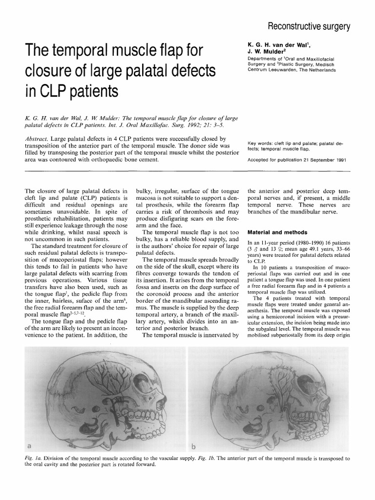 The Temporal Muscle Flap for Closure of Large Palatal Defects in Clp ...