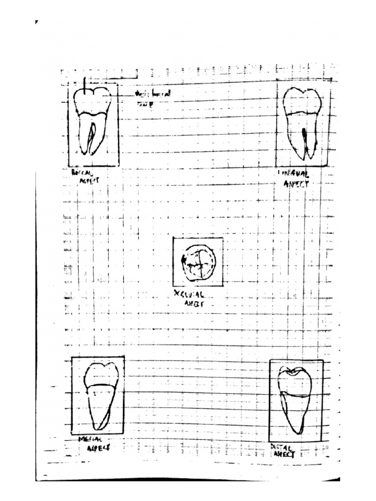 Perm. Mand. 3rd Molar | PDF