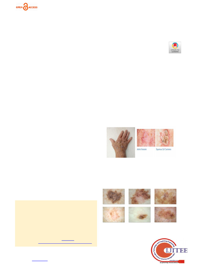 Accuracy Assessment & Classification of Keratosis Skin Lesion | PDF ...