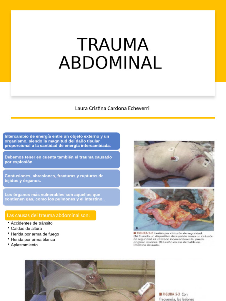 Trauma Abdominal | PDF | Emergencias Médicas | Especialidades Medicas
