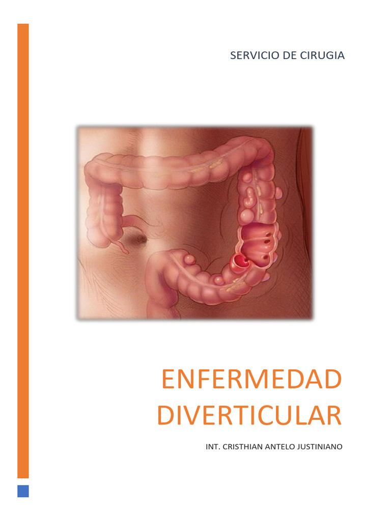 Enfermedad Diverticular | PDF | Enfermedades y trastornos | Especialidades Medicas