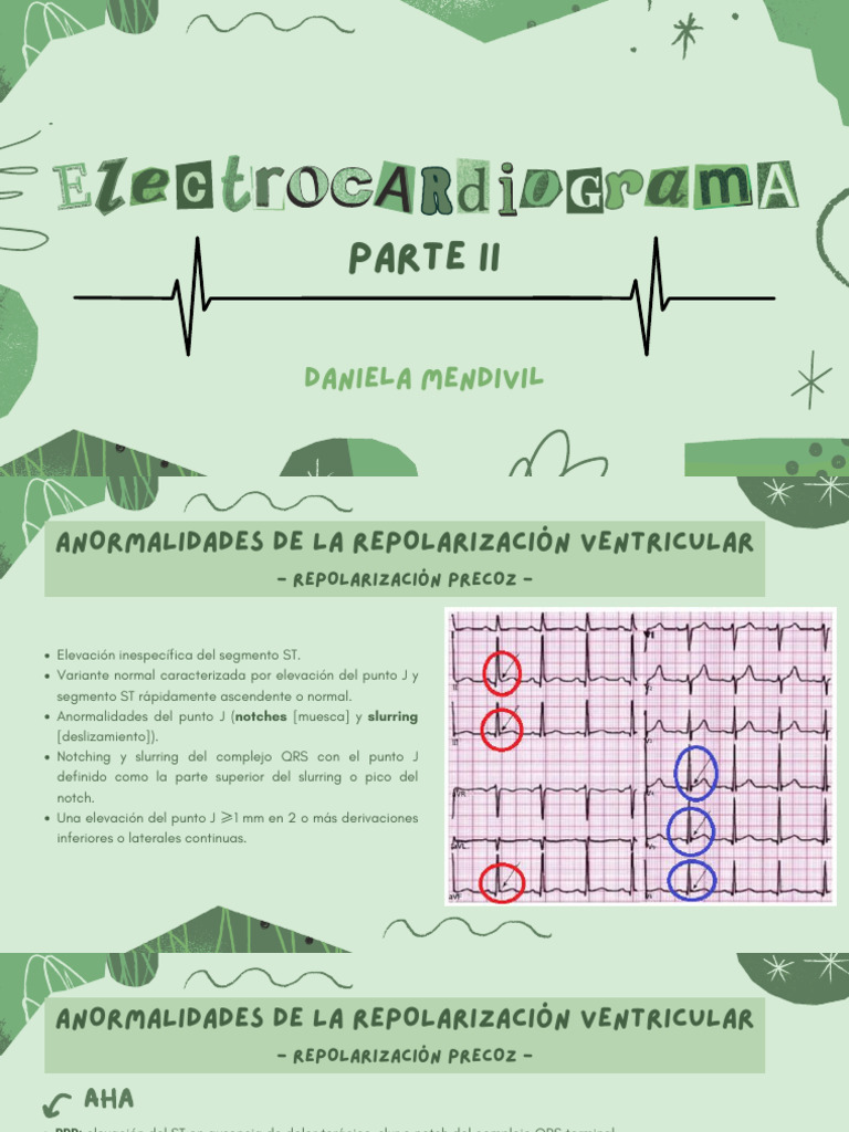 Cardio - Ecg Ii - 20250305 - 083617 - 0000 | PDF | Infarto de miocardio ...