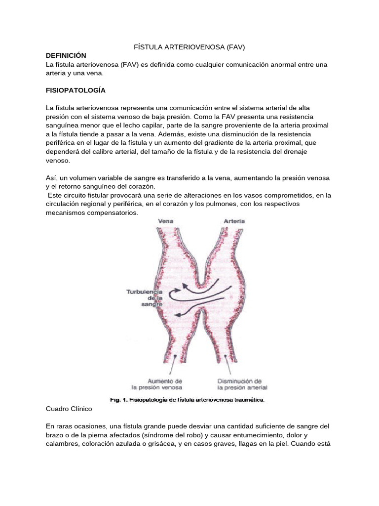 FÍSTULA ARTERIOVENOSA (FAV) | PDF