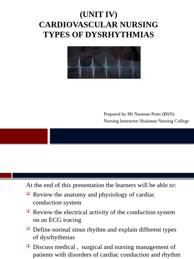 types of dsrhythmias. (1) | PDF | Electrocardiography | Atrium (Heart)