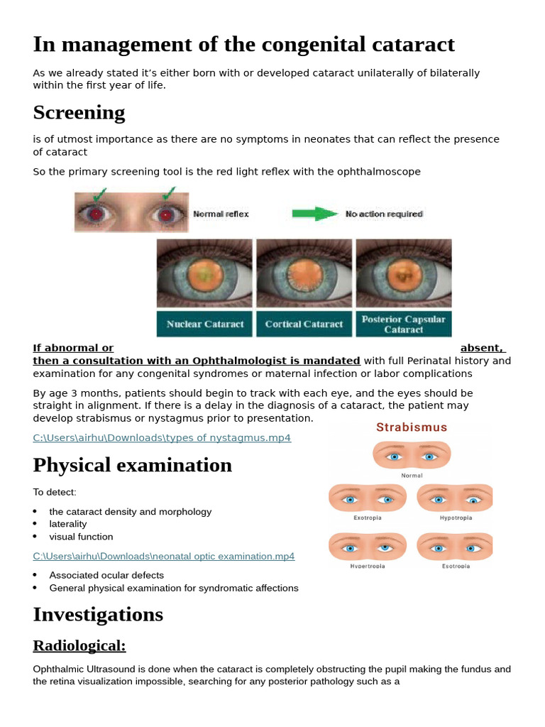 Management of The Congenital Cataract | PDF | Cataract | Human Eye
