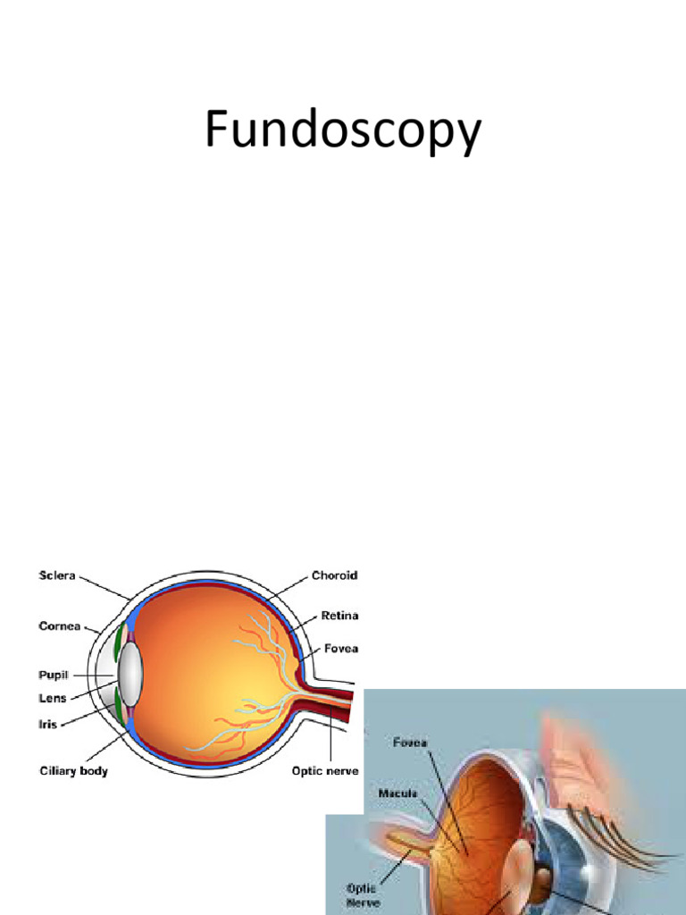 Fundoscopy Techniques and Pathologies | PDF | Human Diseases And ...
