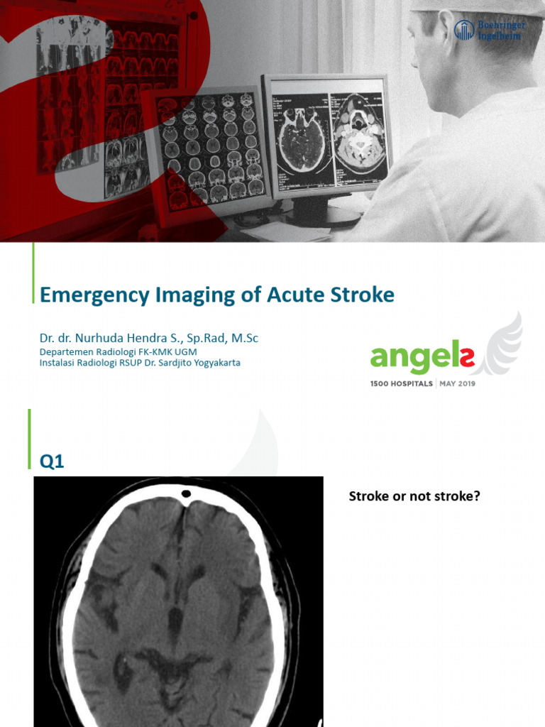 Telementoring Stroke by Sardjiot-Imaging in Stroke - NH - 08092024 ...