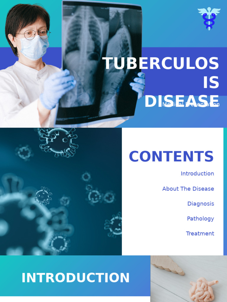 Tuberculosis Disease Overview Guide | PDF | Medicine