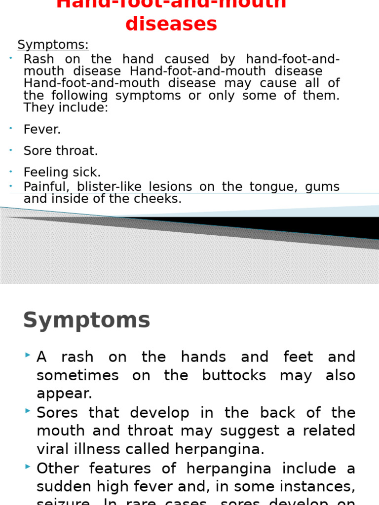Hand-Foot-and-Mouth Disease Overview | PDF | Health Sciences | Medicine