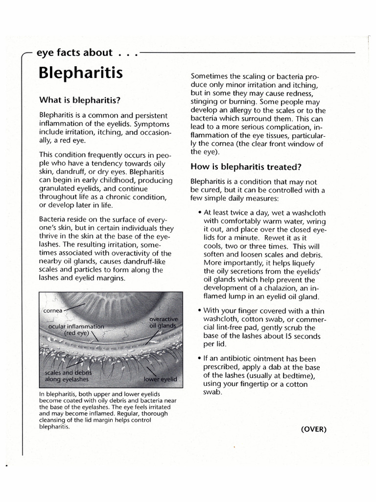 Blepharitis | PDF