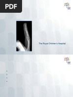 Boxer's Fracture Rehabilitation Protocol | PDF | Injury ...
