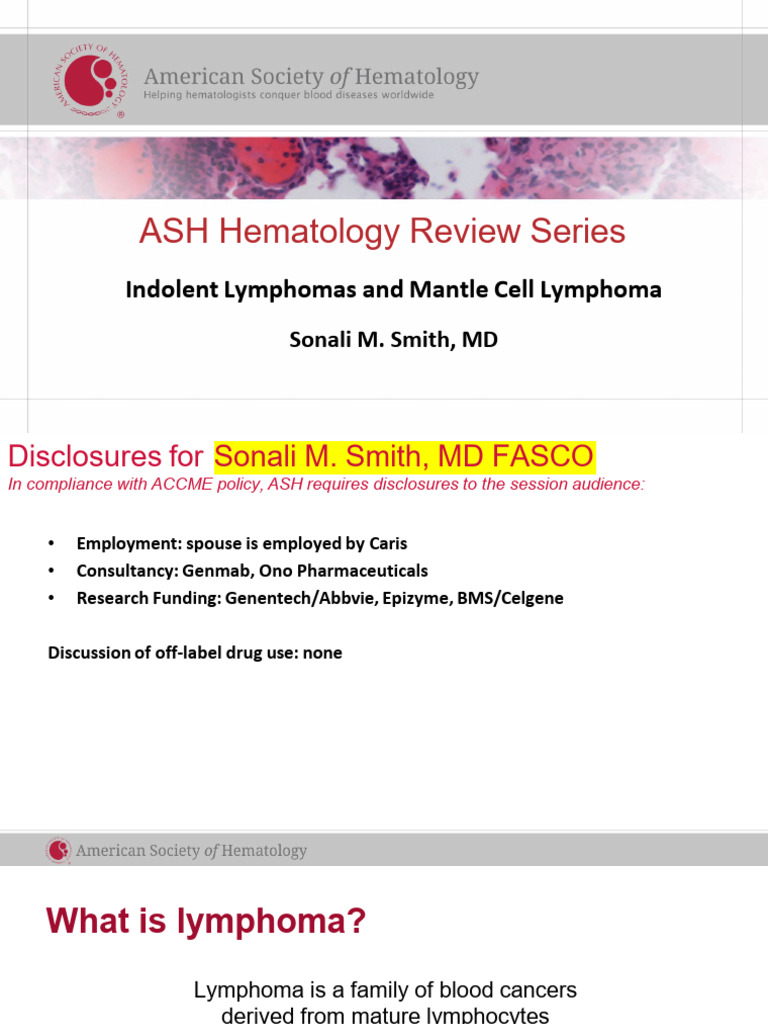 Indolent Lymphomas Overview and Treatment | PDF | Lymphoma | B Cell