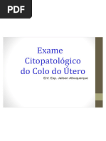 Teste de Schiller | PDF | Câncer cervical | Câncer