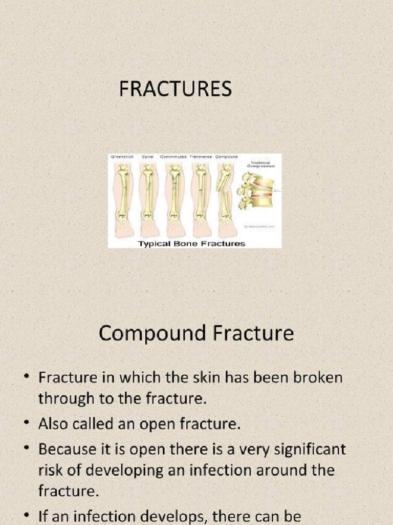 Fractures | PDF