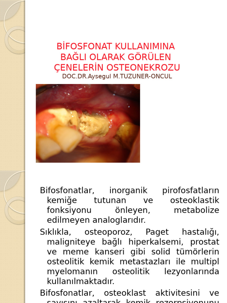 Bifosfonat Ders | PDF