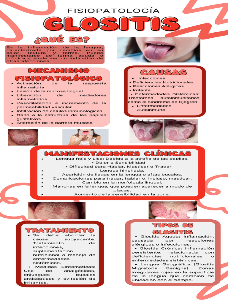 Tratamiento de Glositis: Guía PDF | PDF | Inflamación | Alergia