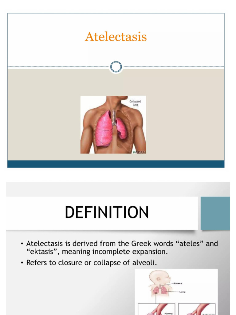 Atelectasis | PDF