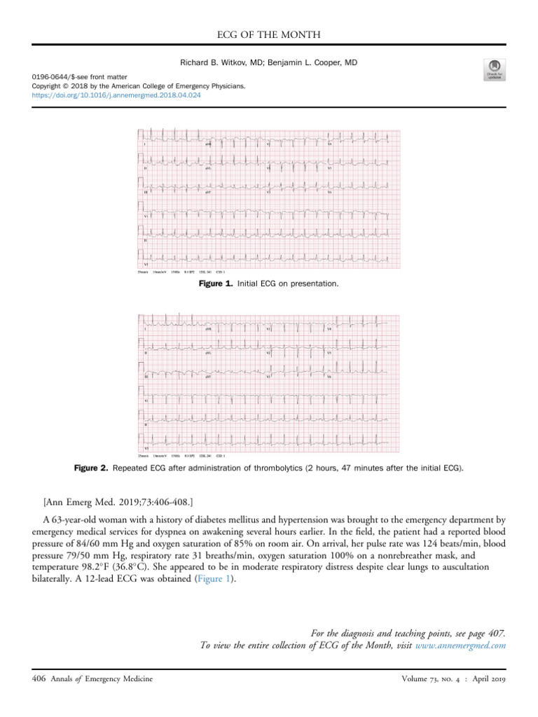 An Ominous ECG Pattern - Ymem | PDF | Electrocardiography | Heart