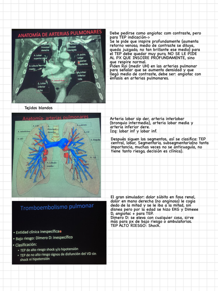 Angiotac para TEP: Protocolo y Hallazgos | PDF | Infarto de miocardio ...