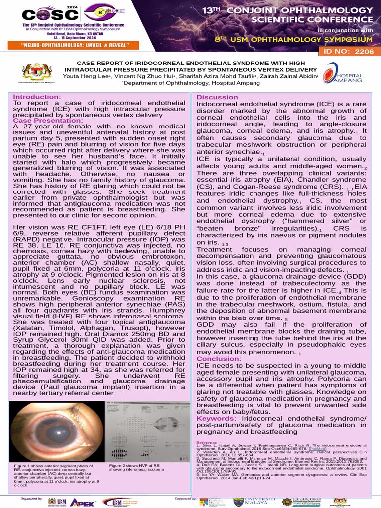 Case Report of Iridocorneal Endothelial Syndrome With High | PDF | Glaucoma | Human Eye