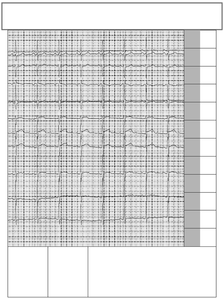 ECG Report: Heart Rate Analysis | PDF | Electrophysiology | Internal ...