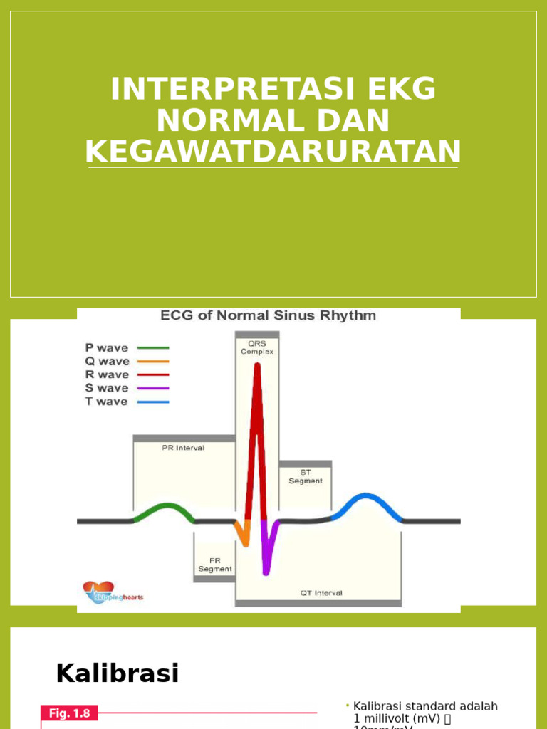 Interpretasi EKG Normal Dan Kegawatdaruratan | PDF