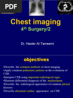 Hilum Overlay Sign in Chest Imaging | PDF