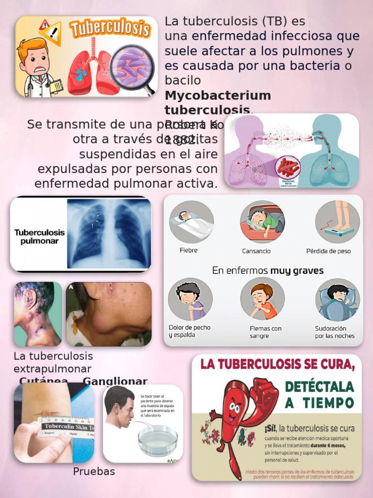 Pendon Tuberculosis | PDF