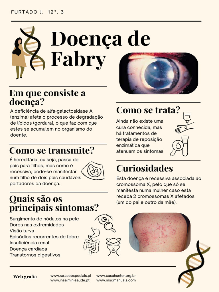 Sintomas e Tratamento da Doença de Fabry | PDF