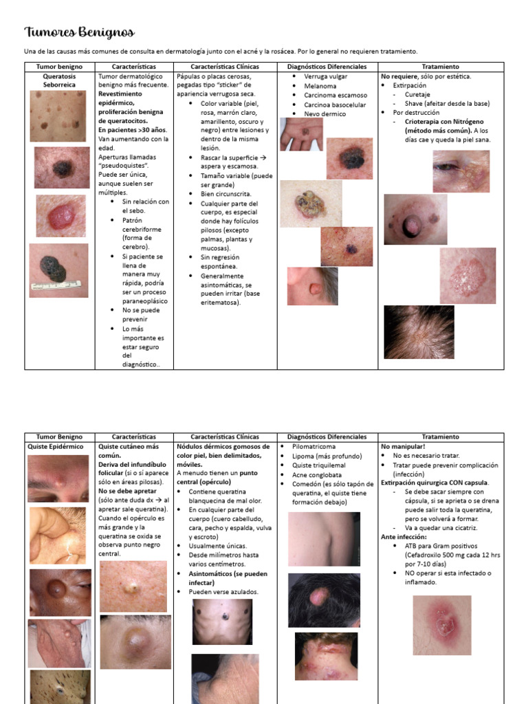 Tumores Benignos | PDF | Neoplasias | Piel