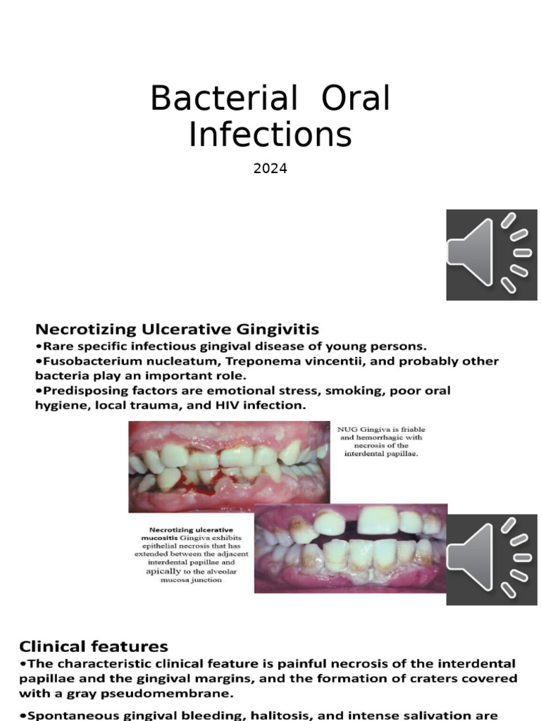 Bactrial Oral Infections | PDF