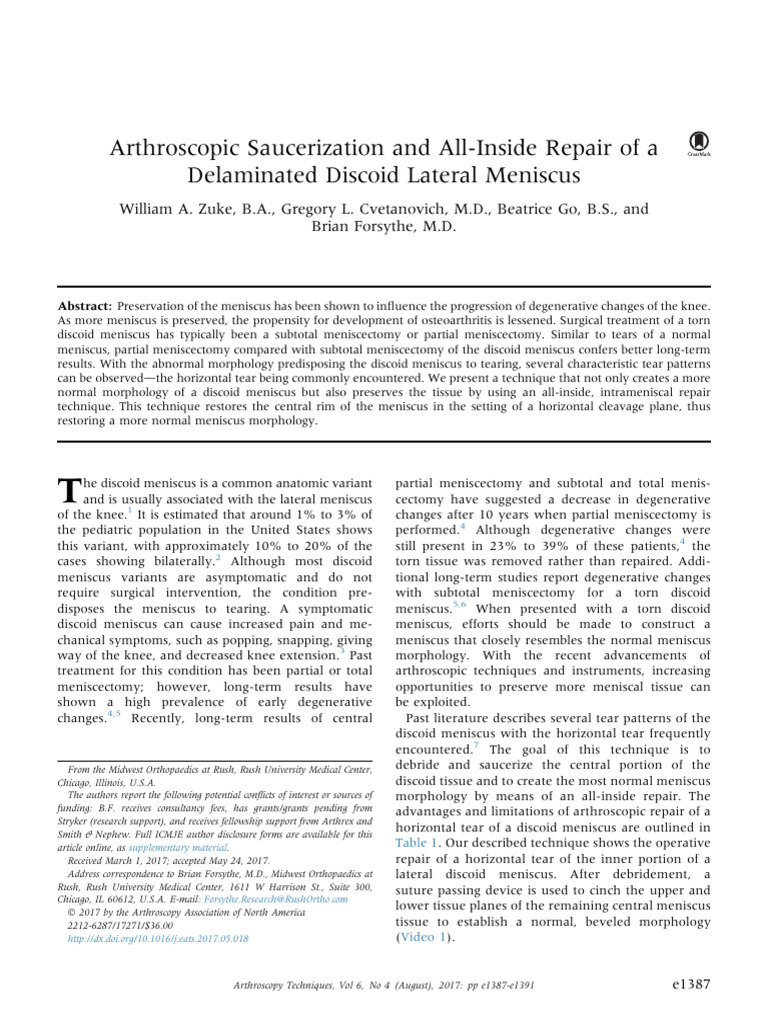 Arthroscopic Saucerization of Discoid Meniscus | PDF | Knee | Lower ...