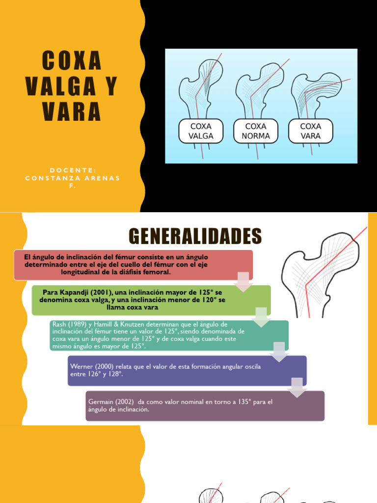 Coxa Vara y Valga | PDF | Sistema esquelético | Sistema musculoesquelético