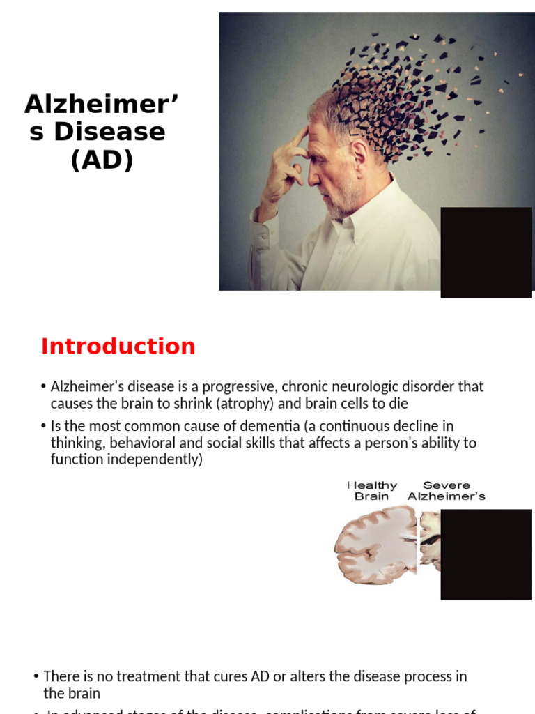 Understanding Alzheimer's Disease Symptoms | PDF | Alzheimer's Disease ...