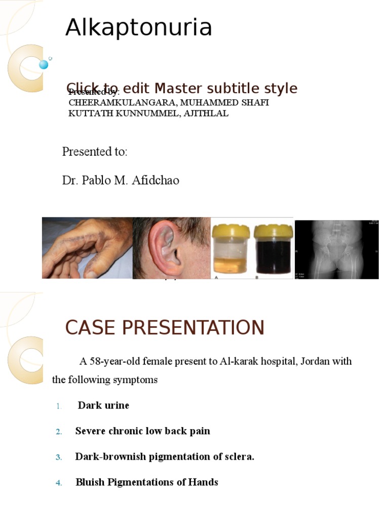 Alkaptonuria Cagayan State University | PDF | Medical Specialties ...
