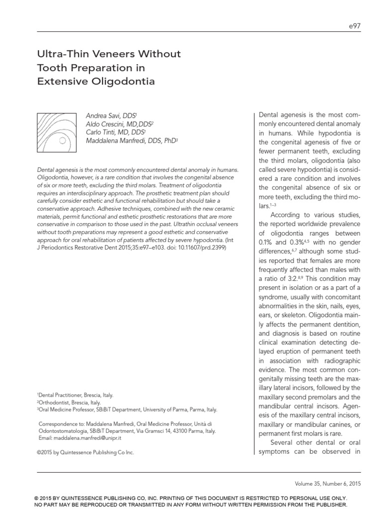 Ultra-Thin Veneers Without Tooth Preparation in Extensive Oligodontia ...