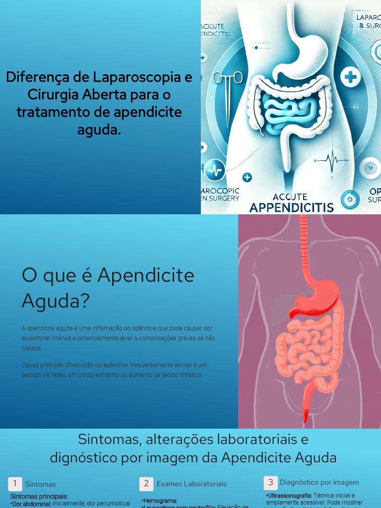 Laparoscopia vs. Cirurgia Aberta: Apendicite | PDF | Doenças e ...