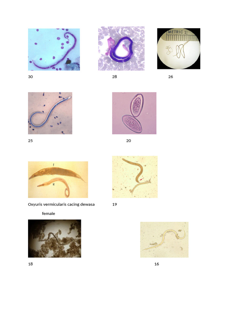 Gambar Parasit 2 | PDF