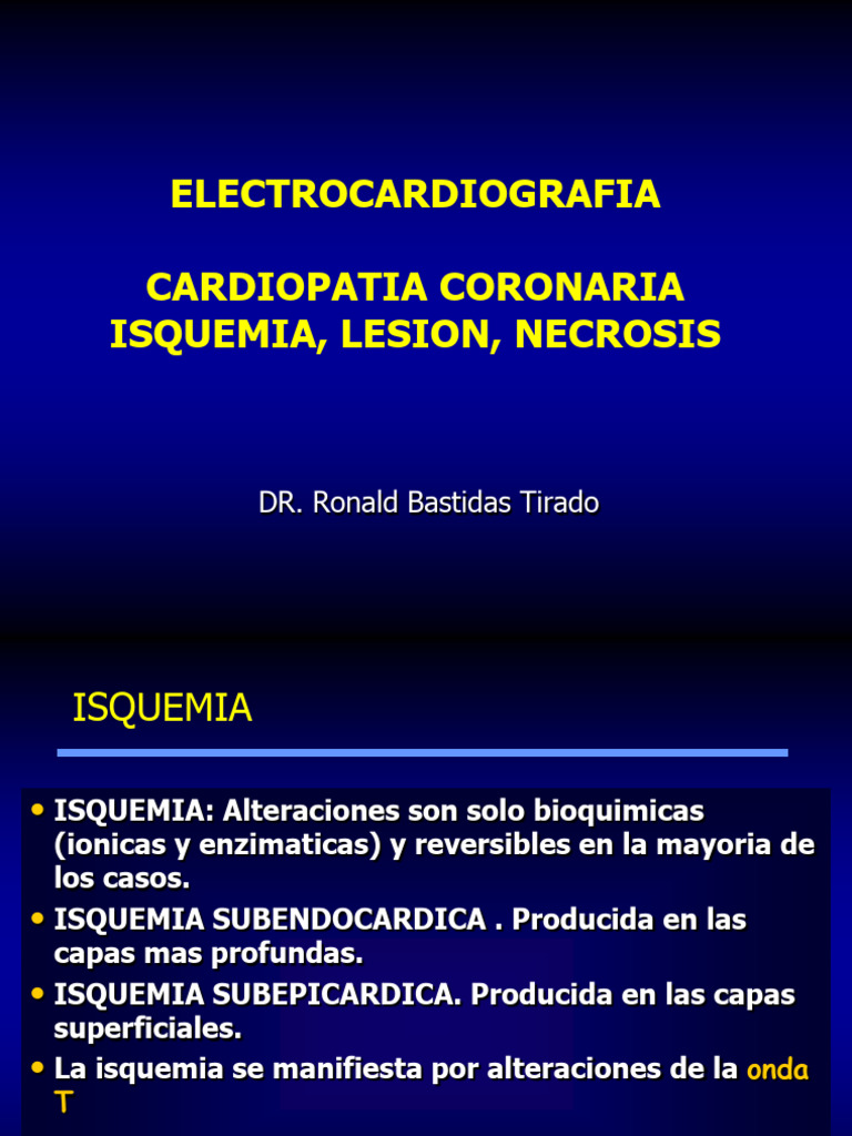 Isquemia y Necrosis en ECG | PDF | Infarto de miocardio | Enfermedades ...