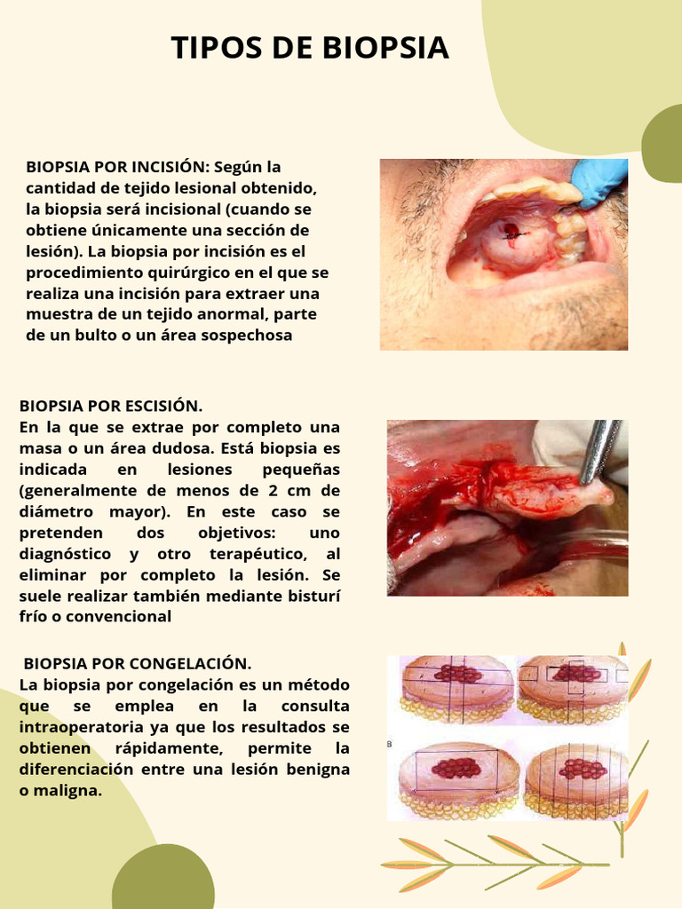 Tipos de Biopsias | PDF | Biopsia | Especialidades Medicas