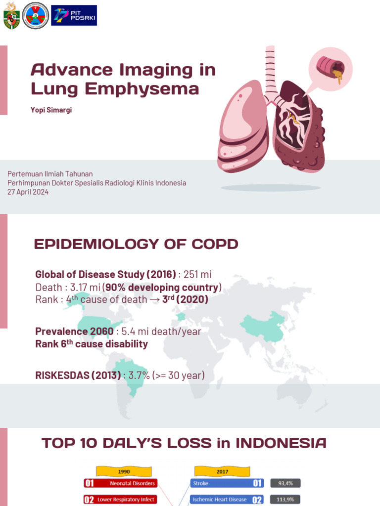 Advance Imaging in Lung Emphysema | PDF | Chronic Obstructive Pulmonary ...