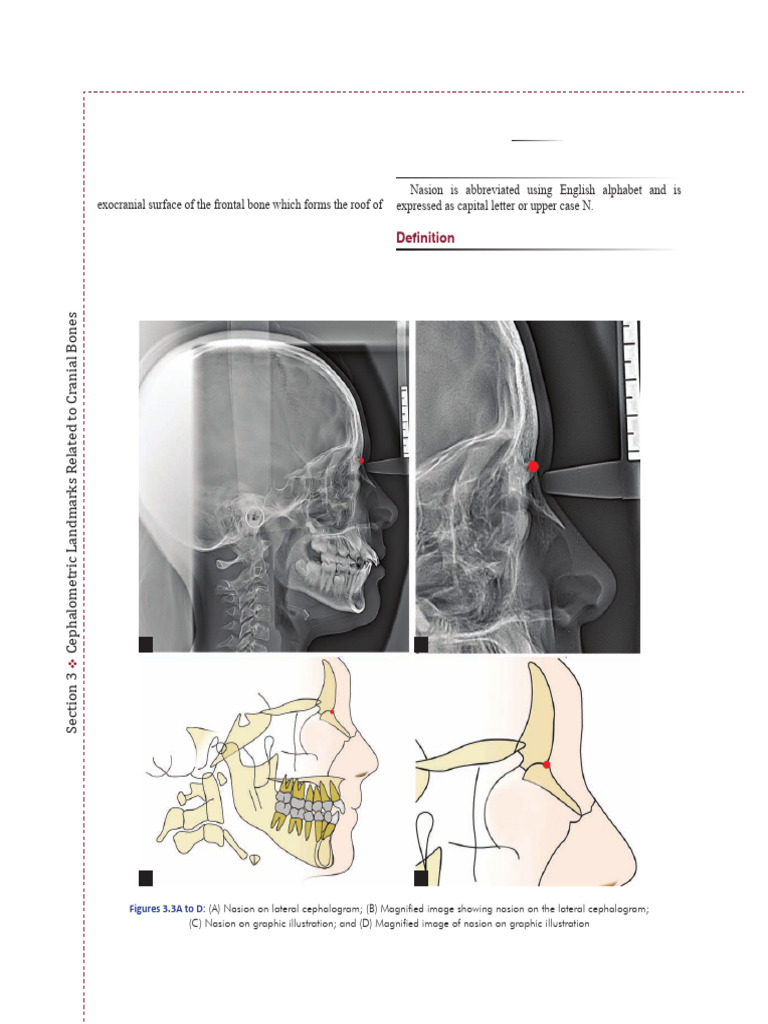 Cephalometric Landmarks of Cranial Bones | PDF | Human Head And Neck ...