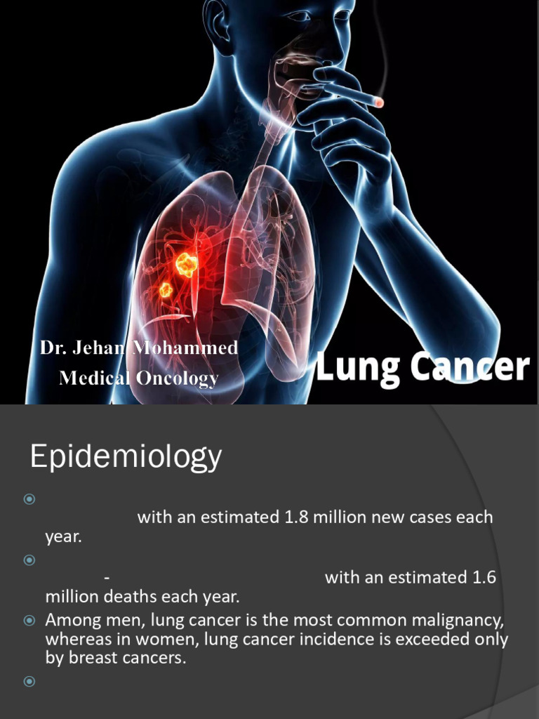 Lung Cancer Overview and Treatment Guide | PDF | Lung Cancer | Cancer
